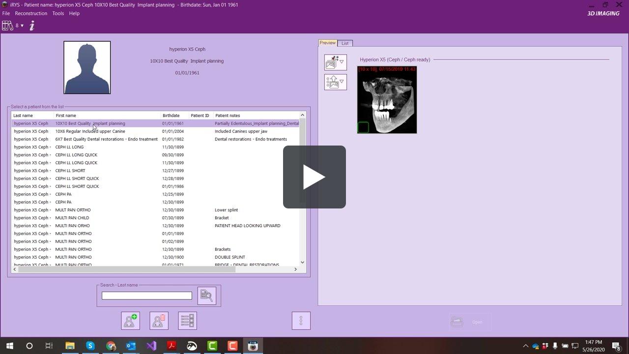 iRYS 11 - Opening Patient Data | Cefla Medical NA