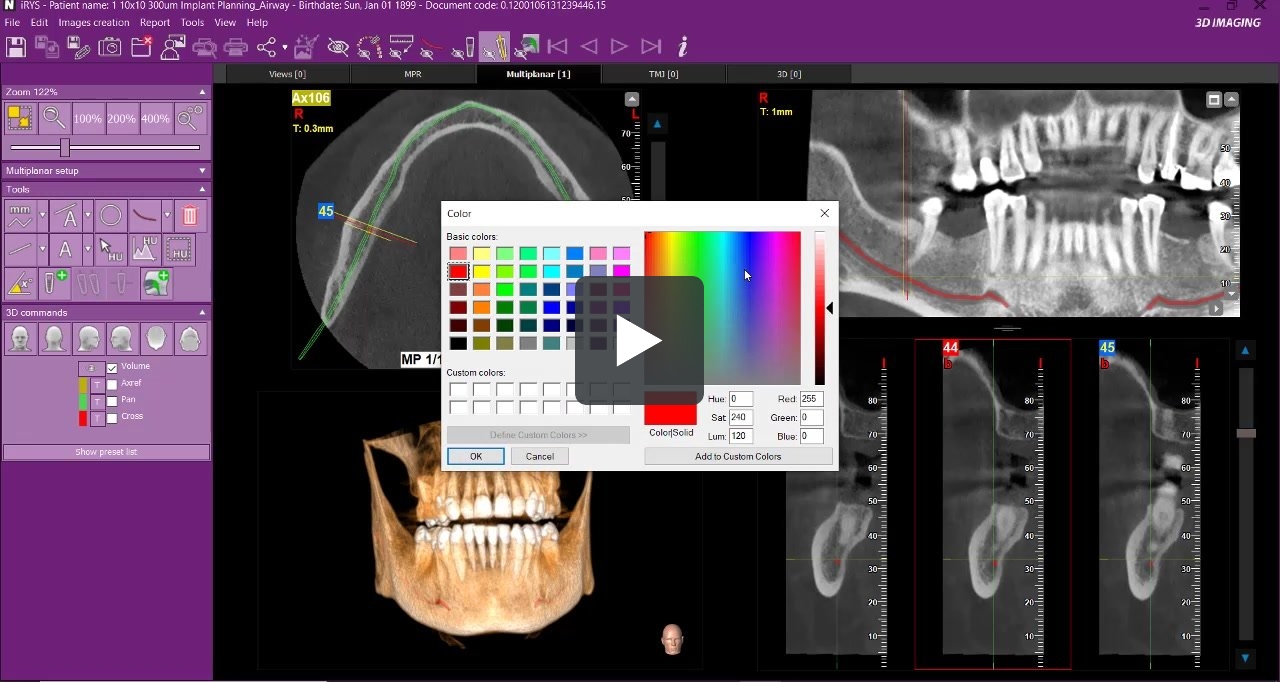 iRYS 11 - Marker Tool | Cefla Medical NA