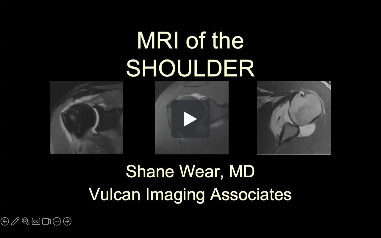 MRI of the Shoulder | American Sports Medicine Institute Video Content