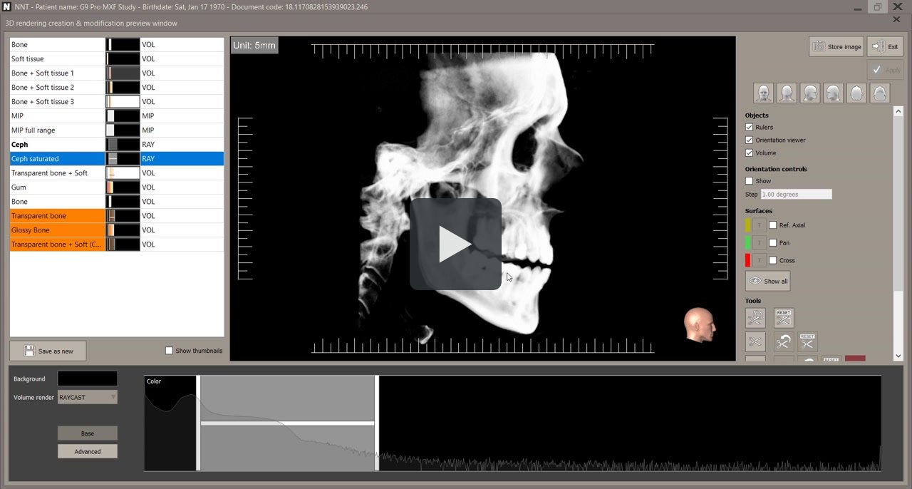 Extract Pan/Ceph from Volume | Cefla Medical NA