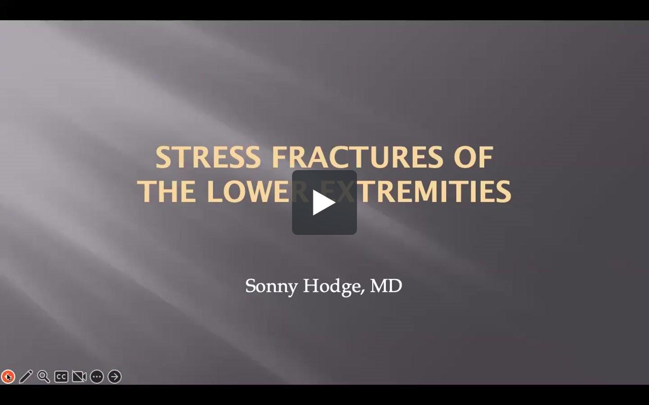 Stress Fx LE | American Sports Medicine Institute Video Content
